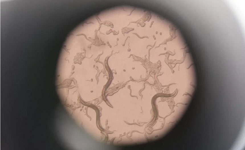 Sugar makes roundworms live longer, finding could help to slow ageing ...