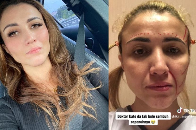 Local celeb Shikin Maembong reveals she has Bell's palsy: 'My smile is ...