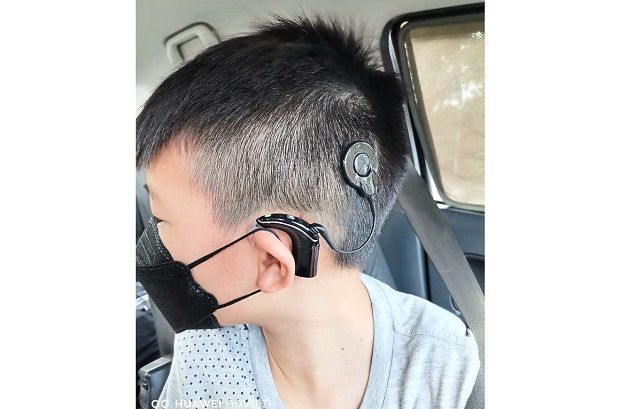 Funds needed to settle boy’s cochlear implant bill | The Star