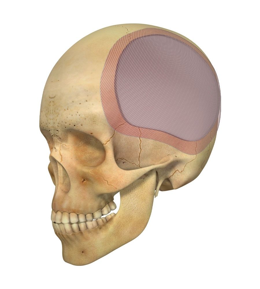 Regrowing the skull bone with 3D printing technology | The Star