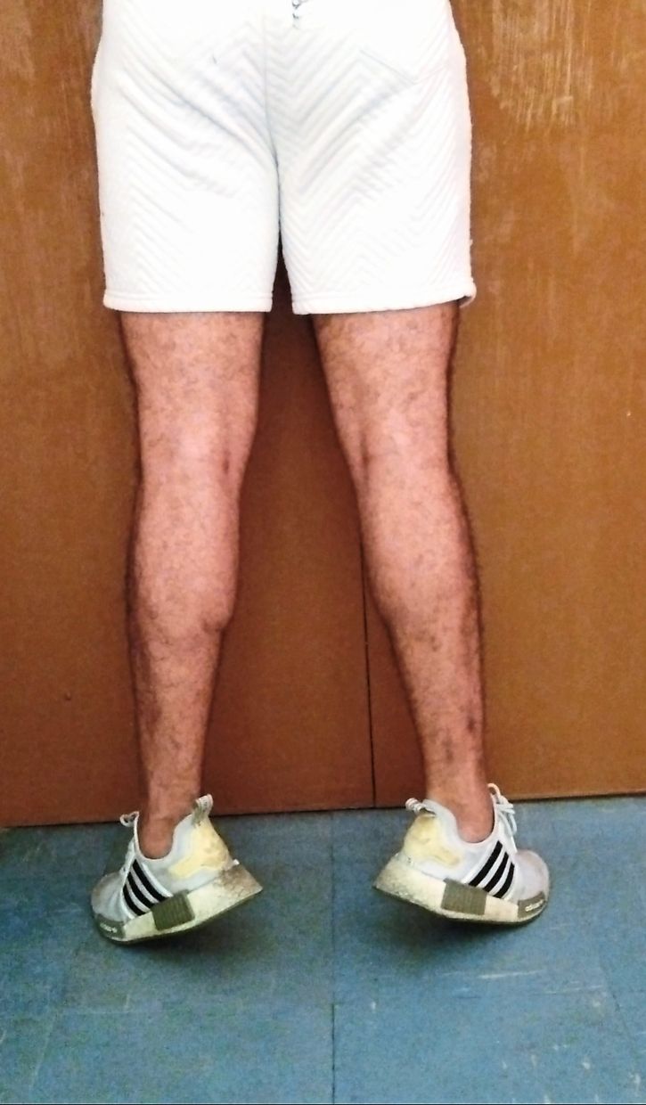 The calves are often overlooked when it comes to exercise | The Star