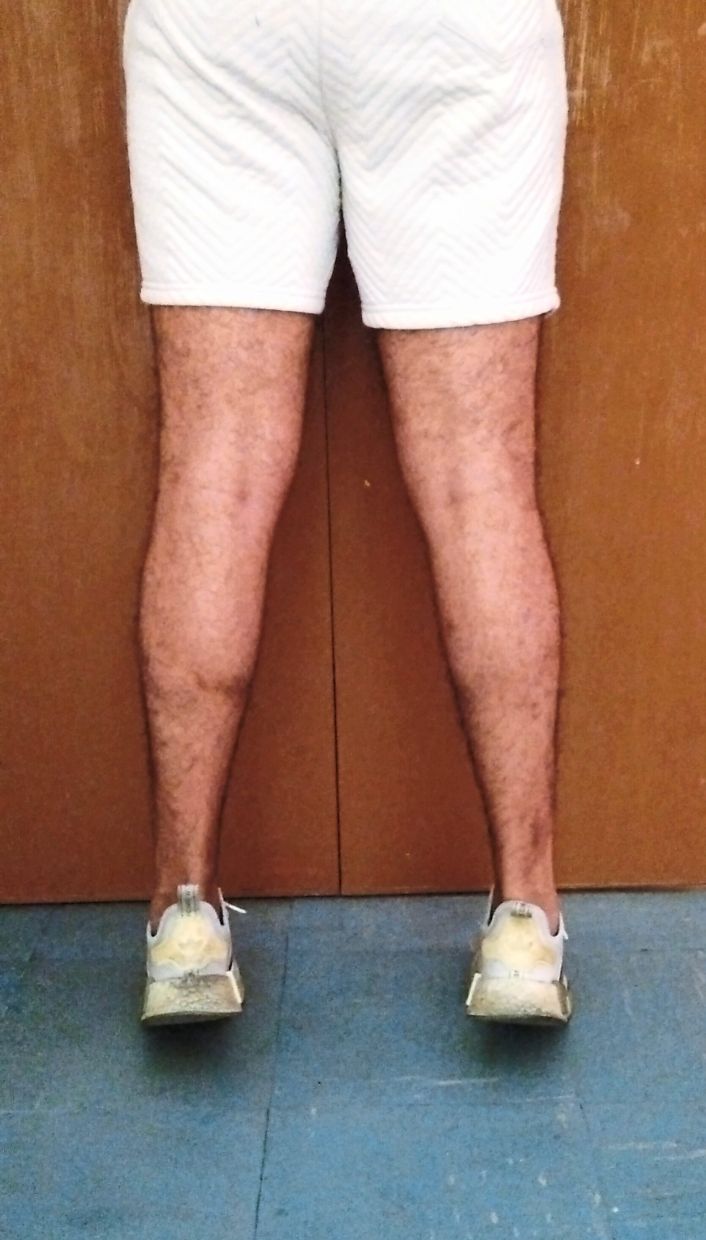 The calves are often overlooked when it comes to exercise | The Star