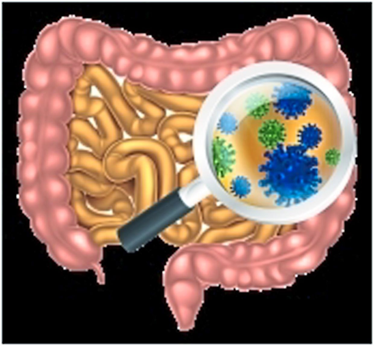 Our gut could be the key to treating HIV | The Star