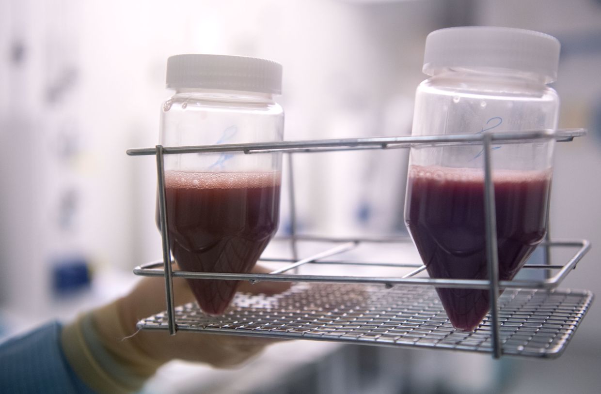 Experimental drugs give new hope to blood cancer patients | The Star