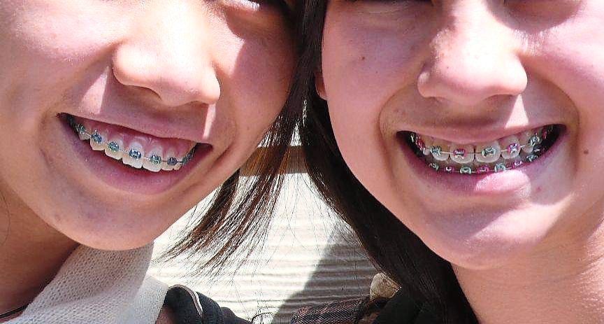 Be wary of braces claims | The Star
