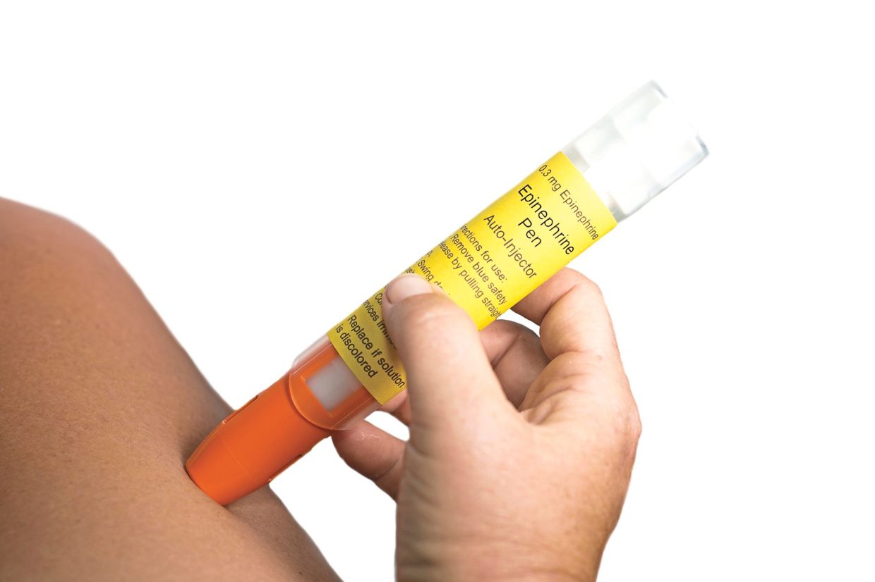 What is an allergy? (Hint: It's related to our immune system) | The Star