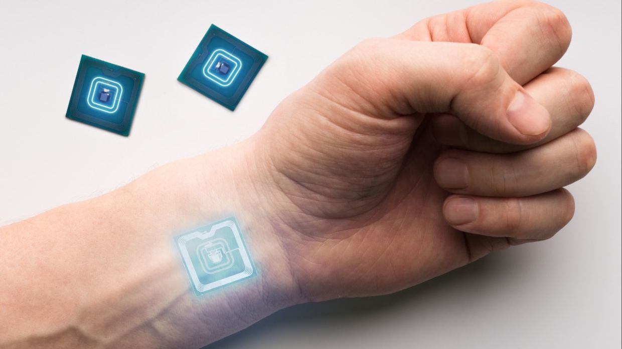 Under the skin: Chinese scientists create wireless charger that can ...