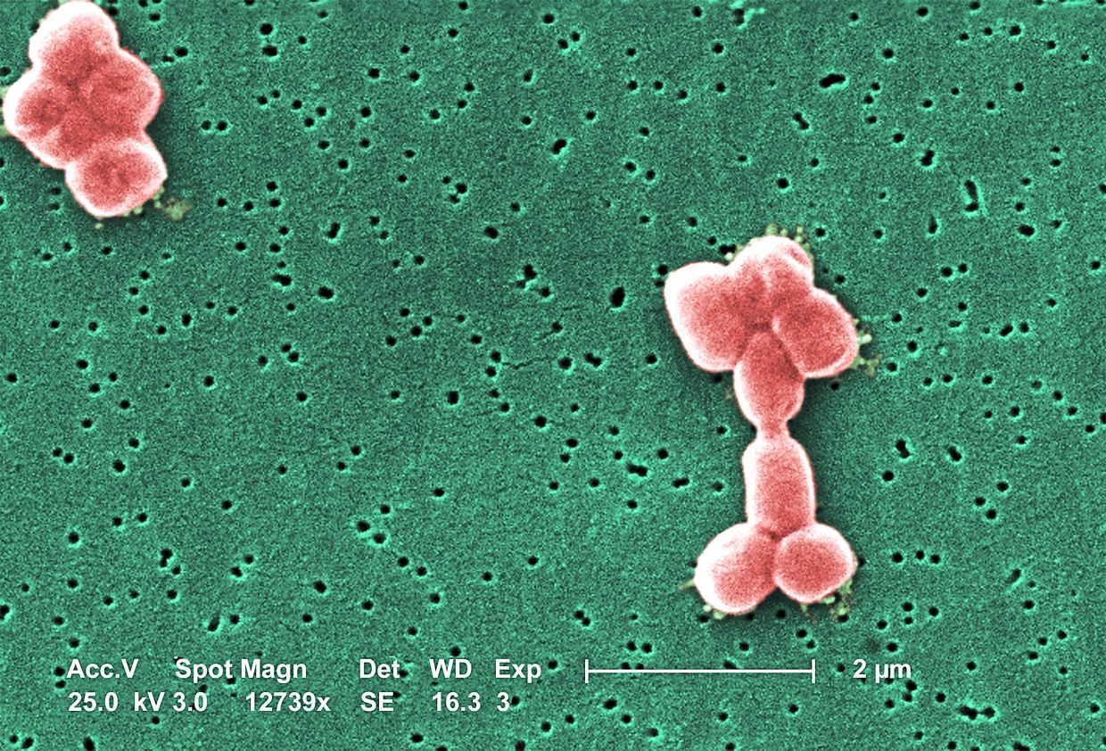 First new antibiotic discovered in 50 years | The Star