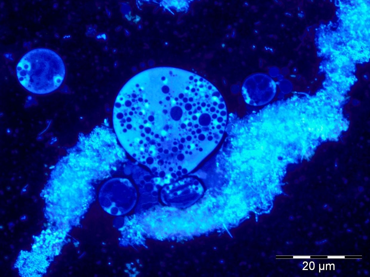 This common parasite is harmless ... until it acts up in our gut | The Star