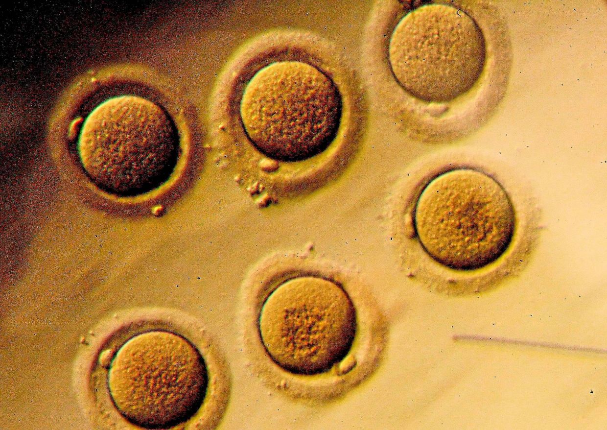 This IVF pioneer transferred his knowledge from animals to humans | The ...