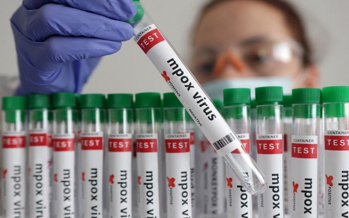 Philippines' active mpox cases rise to 14 but no plans for border ...