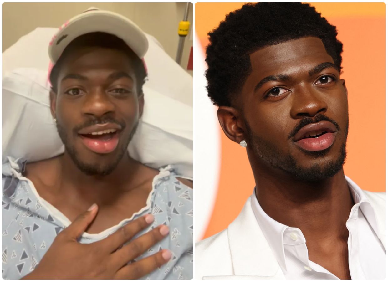Lil Nas X reveals half his face is paralysed: 'Can't even laugh right ...